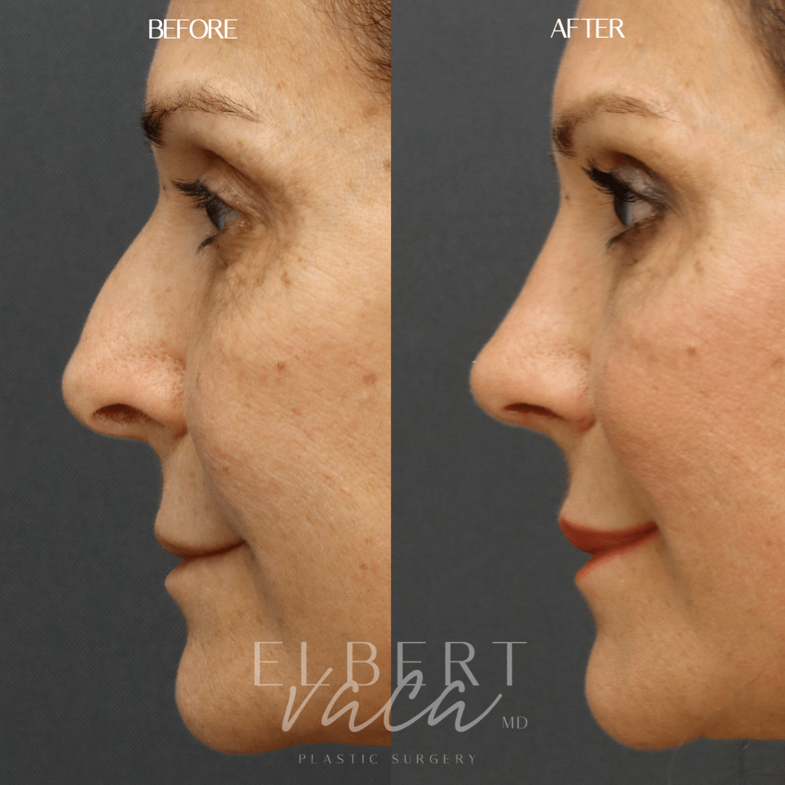 About - Elbert Vaca - Dr. Fagien & Dr. Vaca | Dr. Fagien & Dr. Vaca